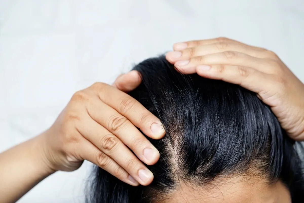 Hair Loss And Skin Rash: 7 Proven Steps - Gold City